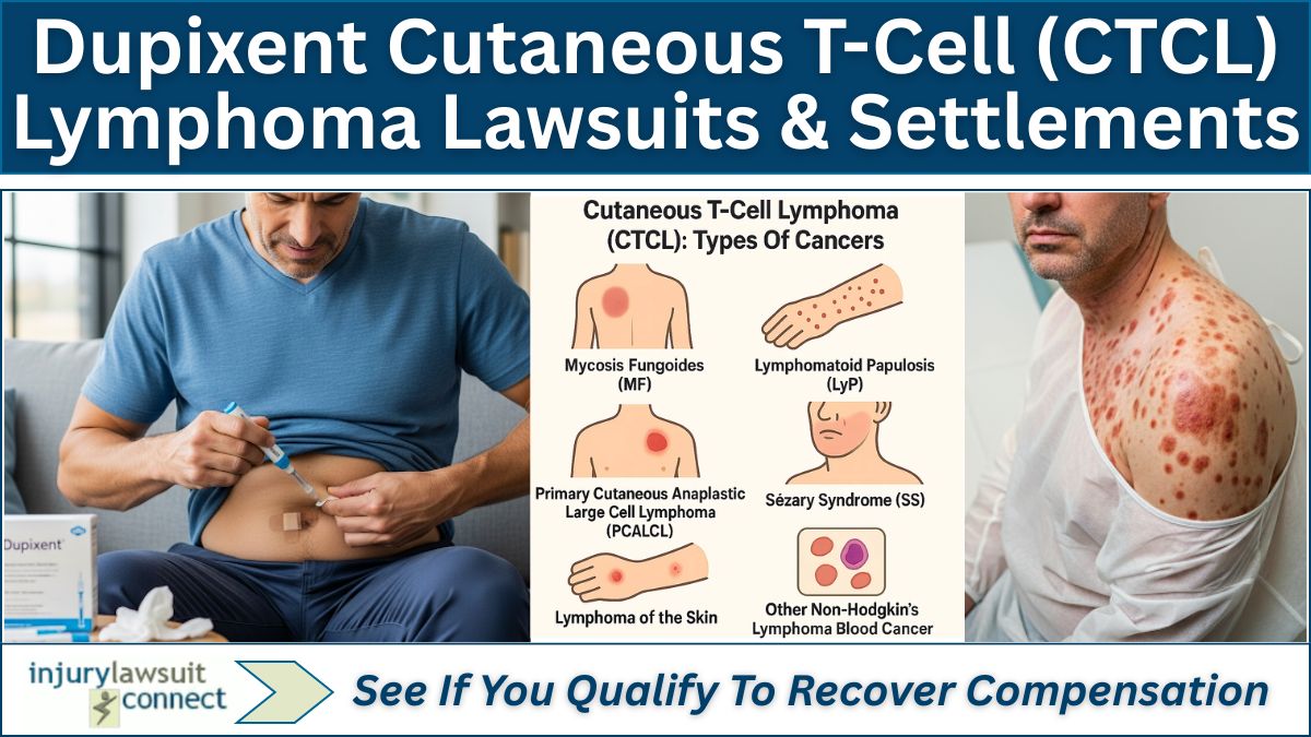 Dupixent T-Cell Lymphoma Lawsuit [2025]: Were You (or A Loved One ...